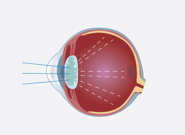 Patient Resources - Meadows Eye Physicians & Surgeons